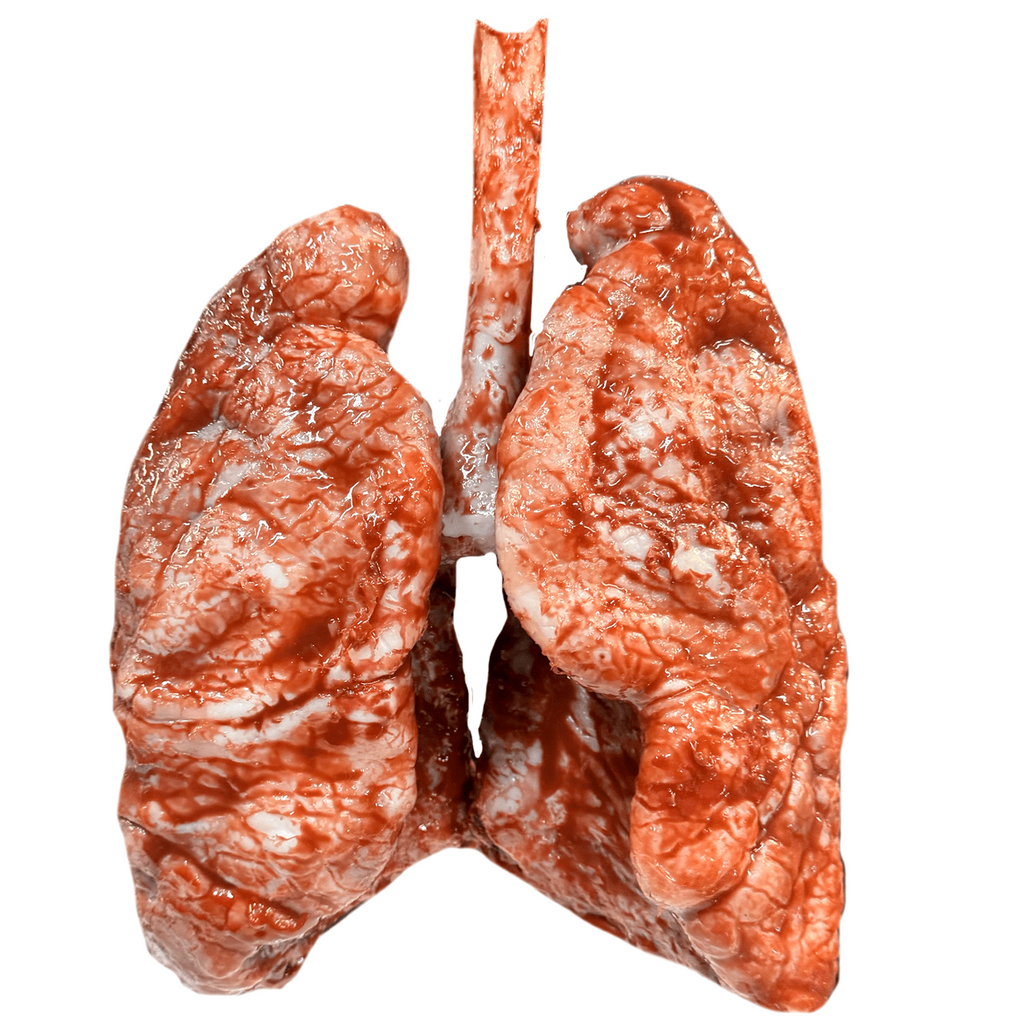 Real Lungs Stanford Medicine Study Flags Unexpected Cells In Lung As